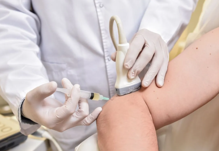 Tratamento da Epicondilite: Dicas Essenciais - Dr. João Basmage